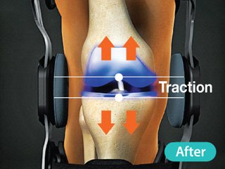 DDS OA PRO - Disc Disease Solutions